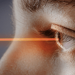 Laser Vision Correction Services in Kansas City, KS | Heart of America ...